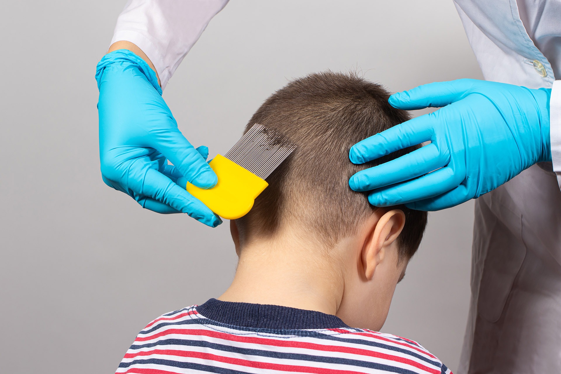 Ką tėveliai turėtų žinoti apie galvines utėles | Militra.lt